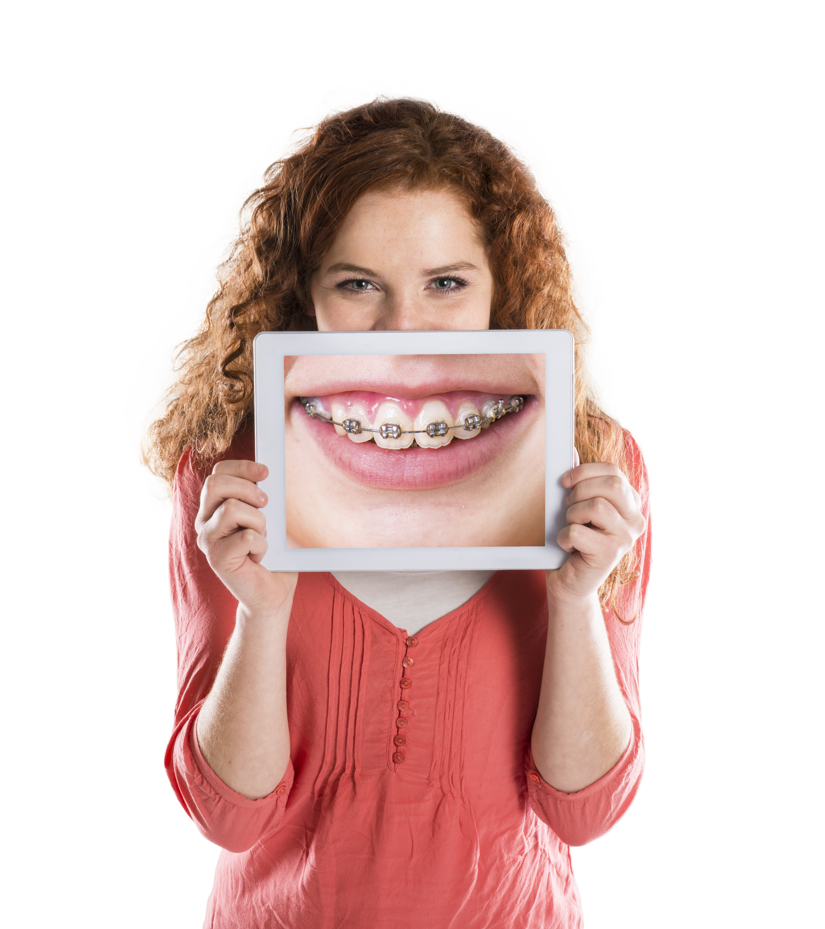 Management of large teeth with orthodontics - Oxnard Gentle Dentistry